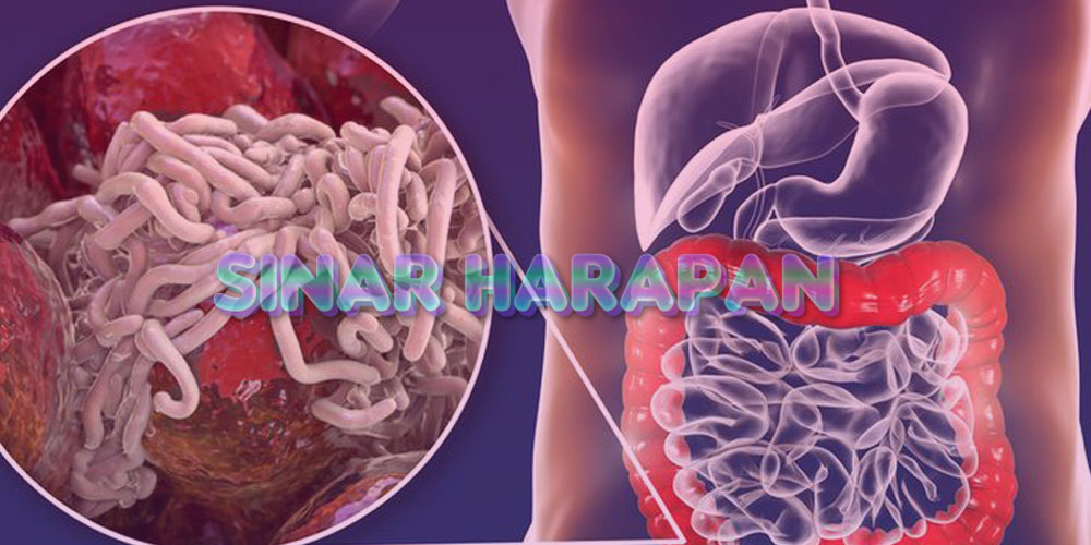 Ini Jenis-jenis Cacing yang Bisa Masuk ke Tubuh Manusia